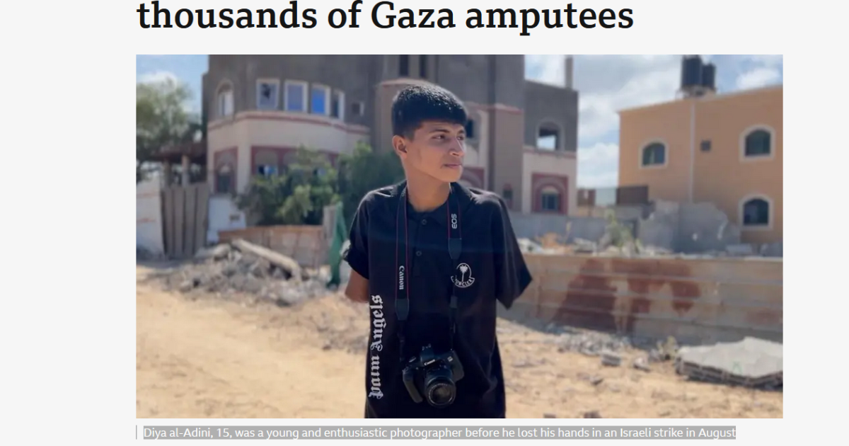 Easy-fit prosthetics offer hope to thousands of Gaza amputees - BBC ...